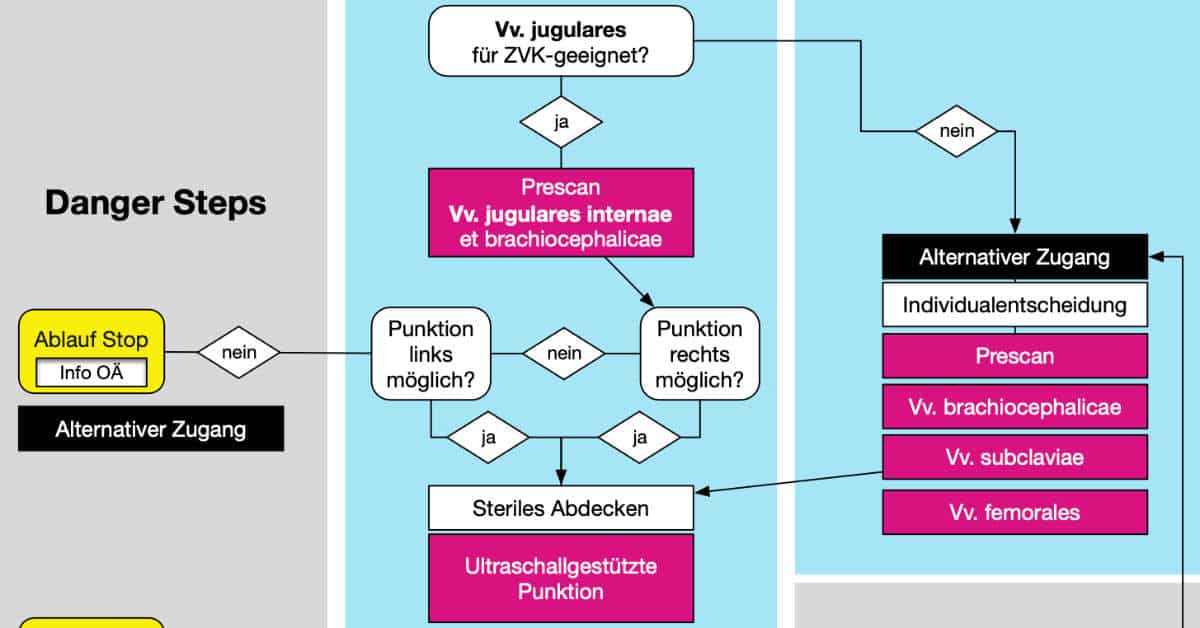 Ultraschall­gestützte V. jugularis Punktion für die ZVK Anlage ...